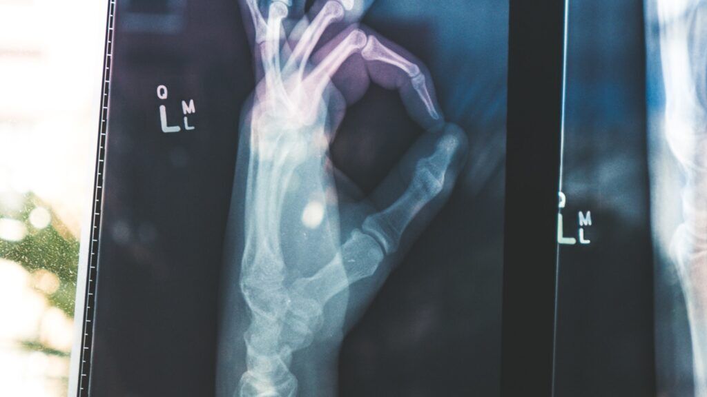 Top Diagnostic Imaging Trends for Elderly Care in 2026-2027