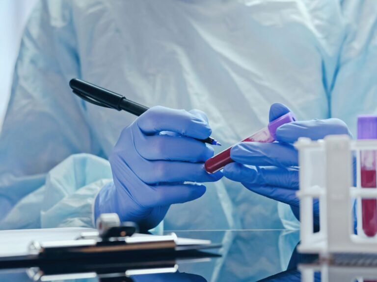 Key Tests Included in Arthritis Panel: A Comprehensive Guide