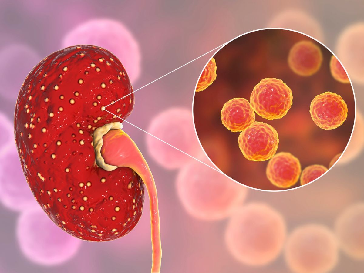 Common Electrolyte Panel Abnormalities Explained in Detail