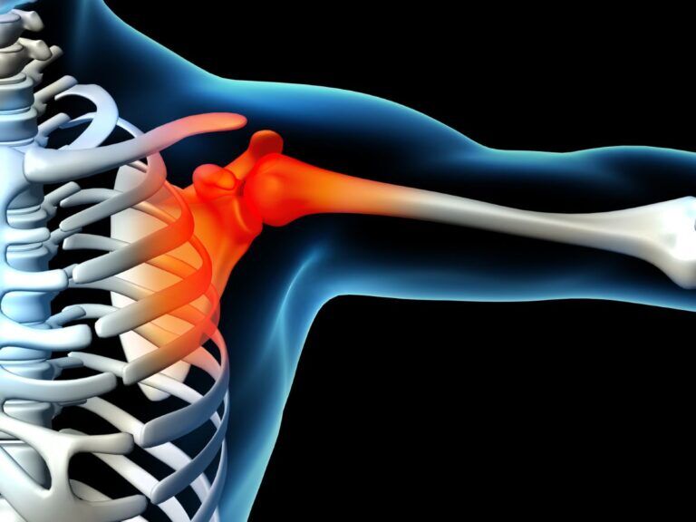 B-Read Chest X-Ray | All Seniors Foundation